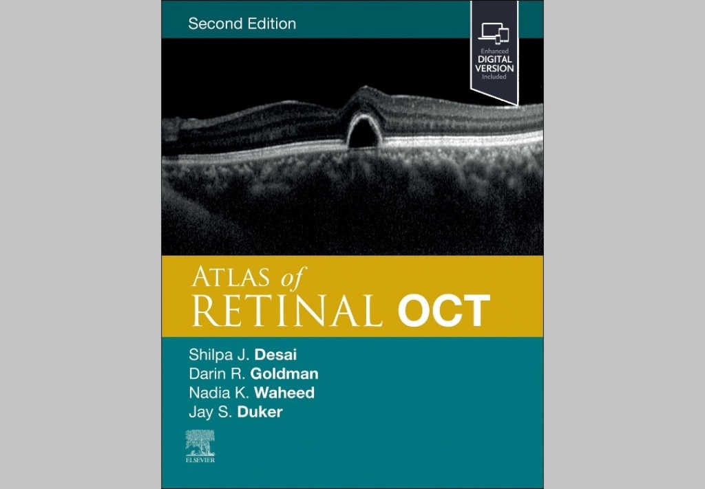 Book review: Atlas of Retinal OCT: Optical Coherence Tomography 2nd Edition