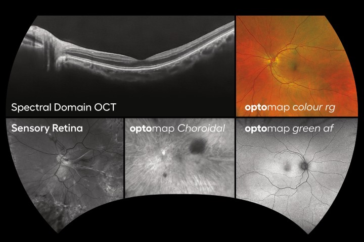 Optos unveils MonacoPro