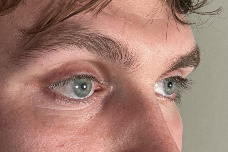 Potential game-changing 3D-printed eye prostheses