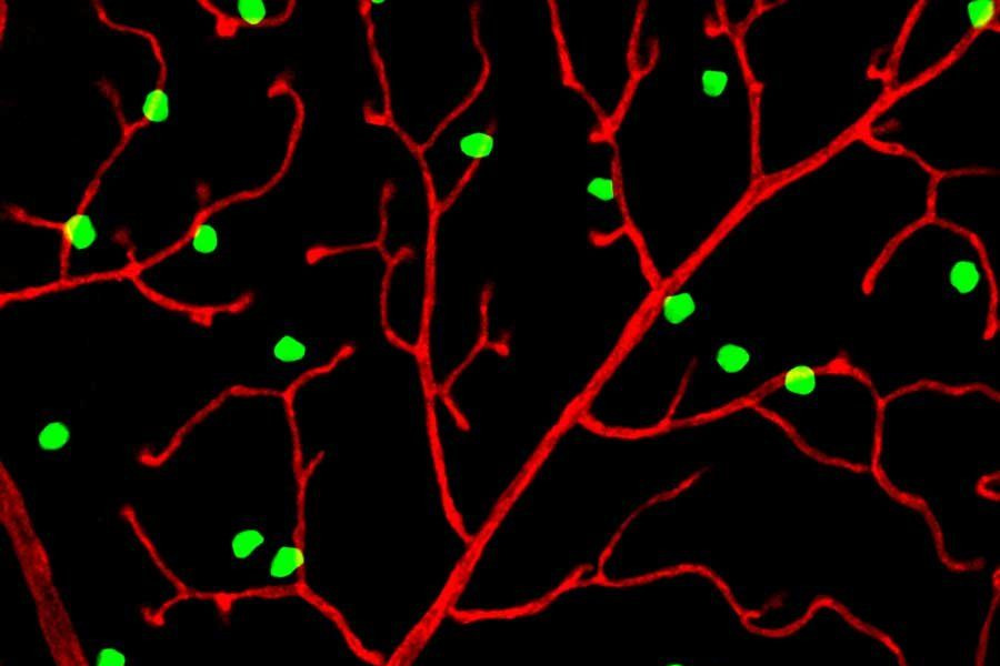 Specialised neurons guide vascularisation
